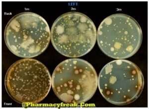 ASEPTIC AREA
